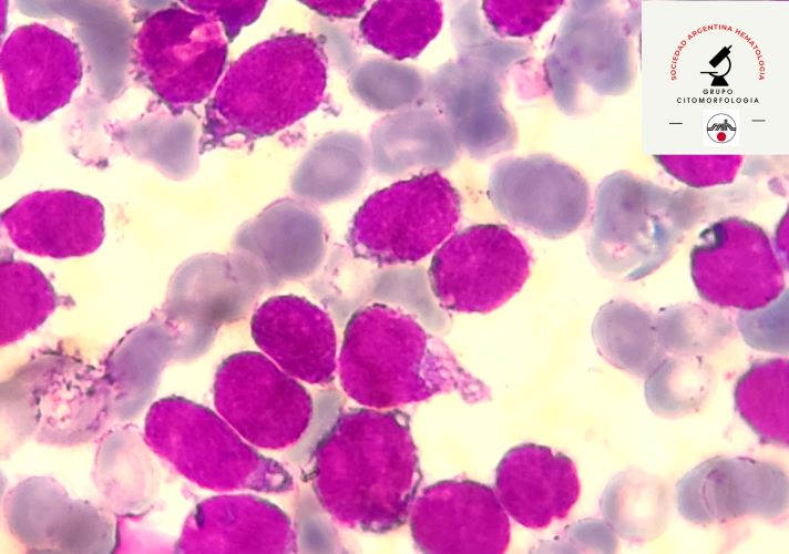 Sociedad Argentina de Hematología