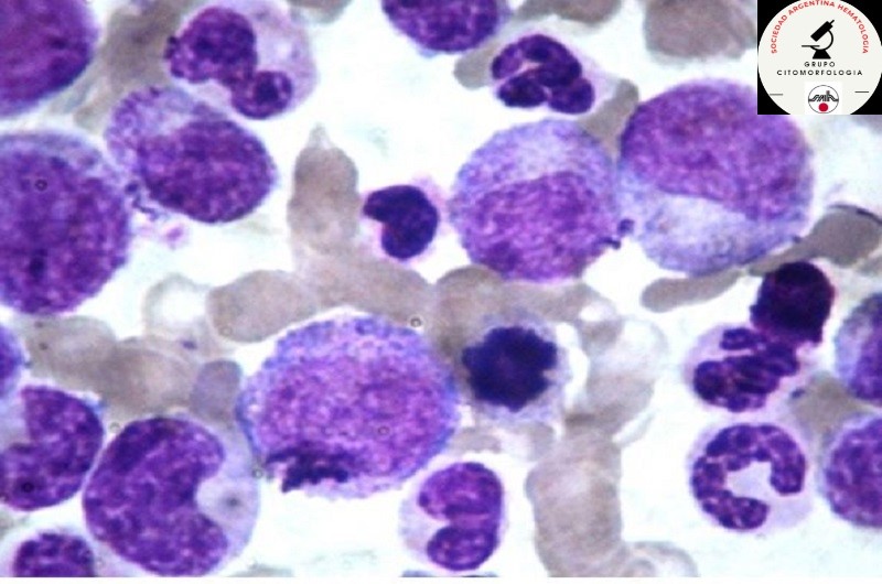 Sociedad Argentina de Hematología