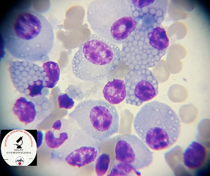 Sociedad Argentina de Hematología