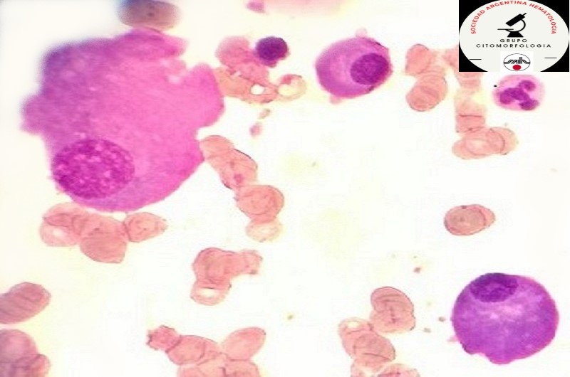 Sociedad Argentina de Hematología