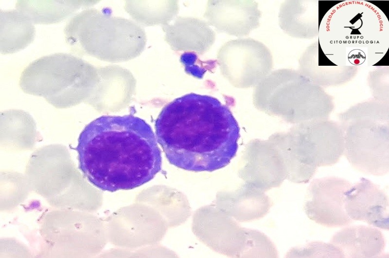 Sociedad Argentina de Hematología