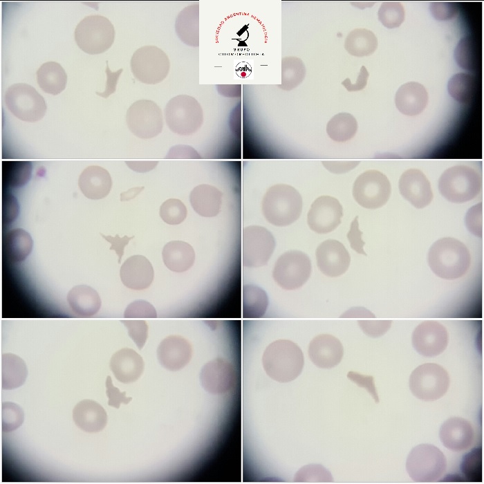 Sociedad Argentina de Hematología